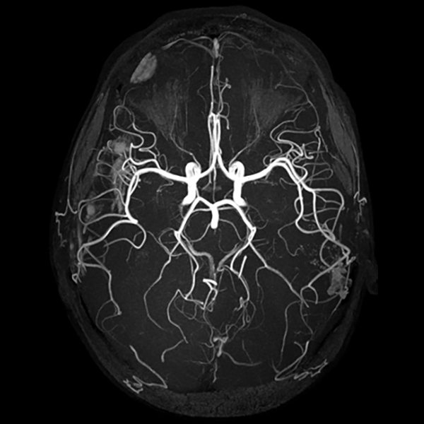 Indiana's Top Radiology Experts | Radiology of Indiana