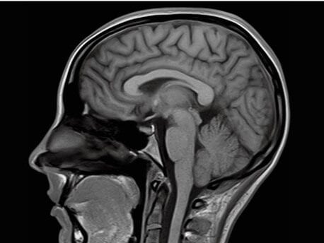 MRI Scan | Radiology of Indiana